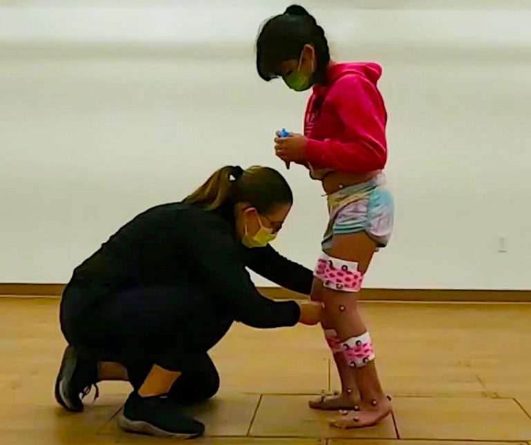 Motion Analysis & Human Performance Lab | Rady Children's Health