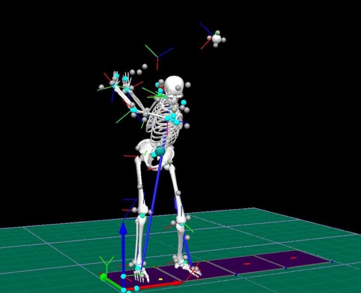 Motion Analysis & Human Performance Lab | Rady Children's Health